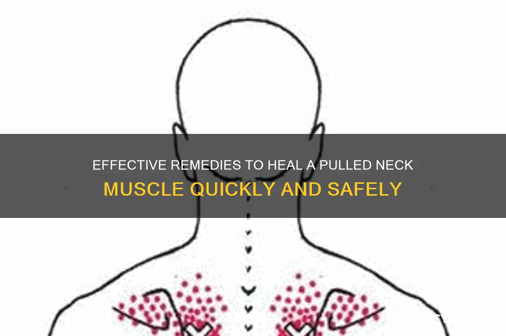 Effective Remedies To Heal A Pulled Neck Muscle Quickly And Safely ...