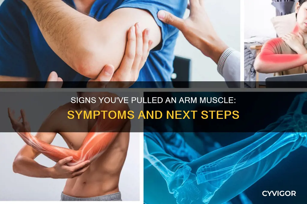 Signs You ve Pulled An Arm Muscle Symptoms And Next Steps CyVigor