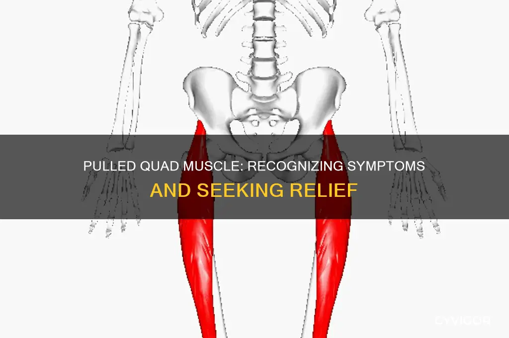 Pulled Quad Muscle: Recognizing Symptoms And Seeking Relief | CyVigor