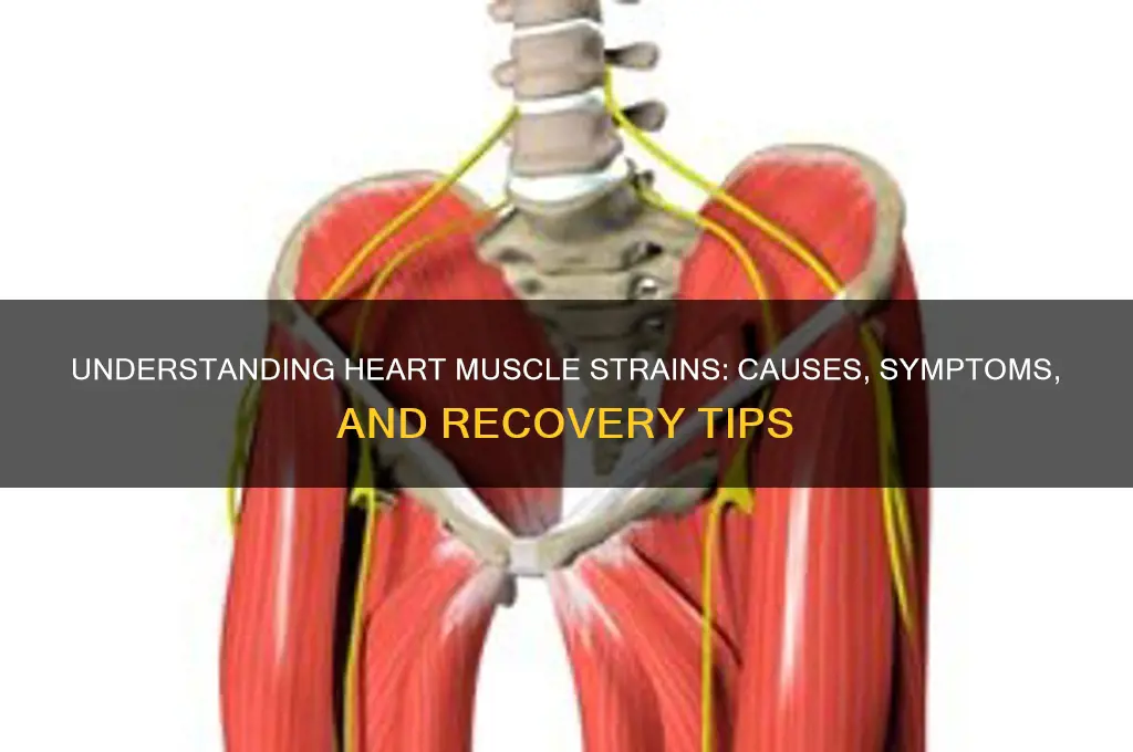 Understanding Heart Muscle Strains: Causes, Symptoms, And Recovery Tips ...