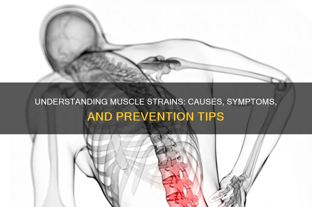Understanding Muscle Strains: Causes, Symptoms, And Prevention Tips ...