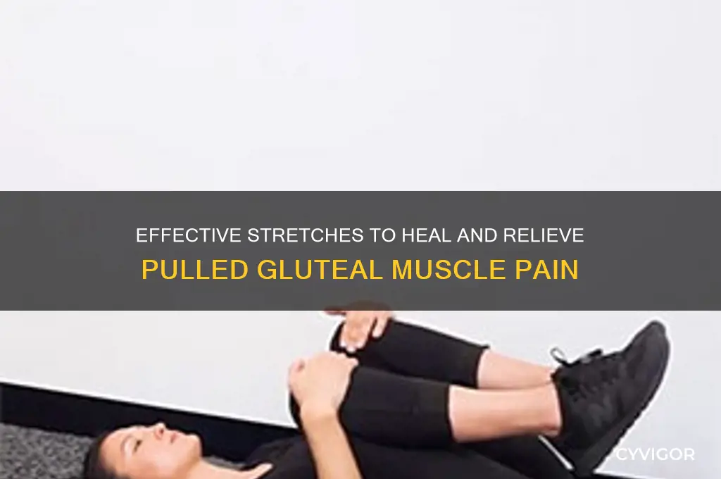 Effective Stretches To Heal And Relieve Pulled Gluteal Muscle Pain ...