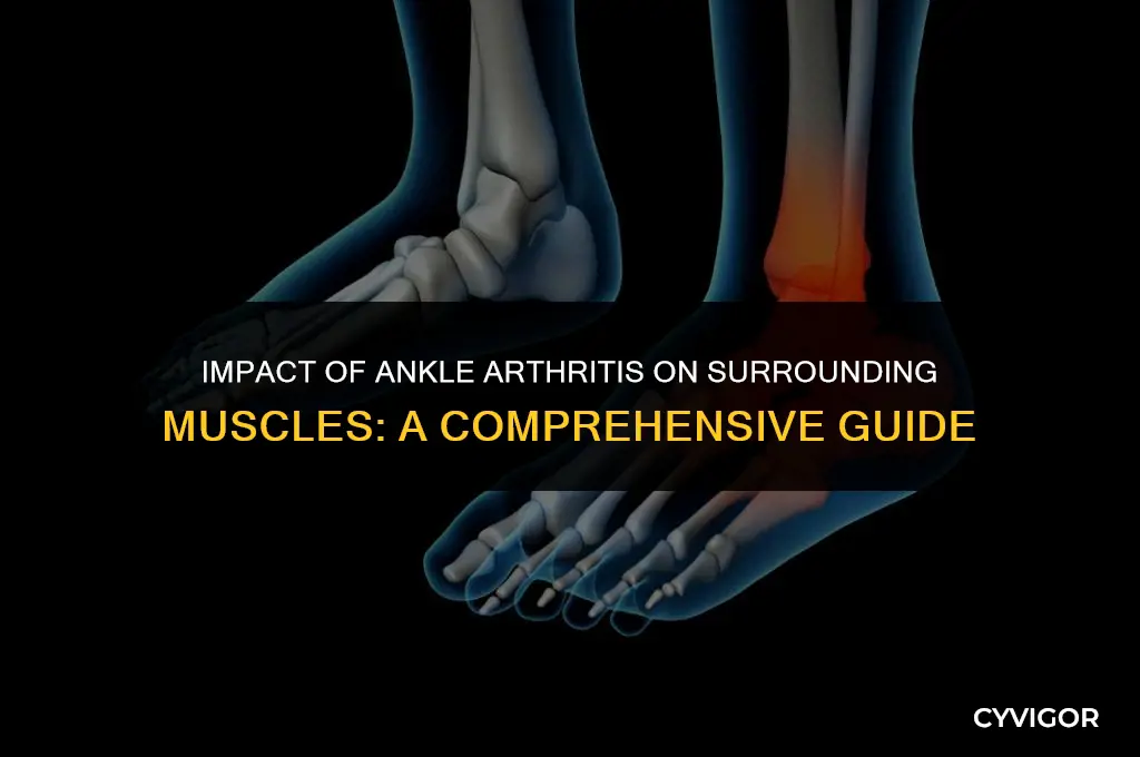 Impact Of Ankle Arthritis On Surrounding Muscles: A Comprehensive Guide ...