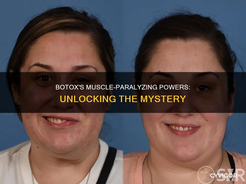 Botox's Muscle-Paralyzing Powers: Unlocking The Mystery | CyVigor