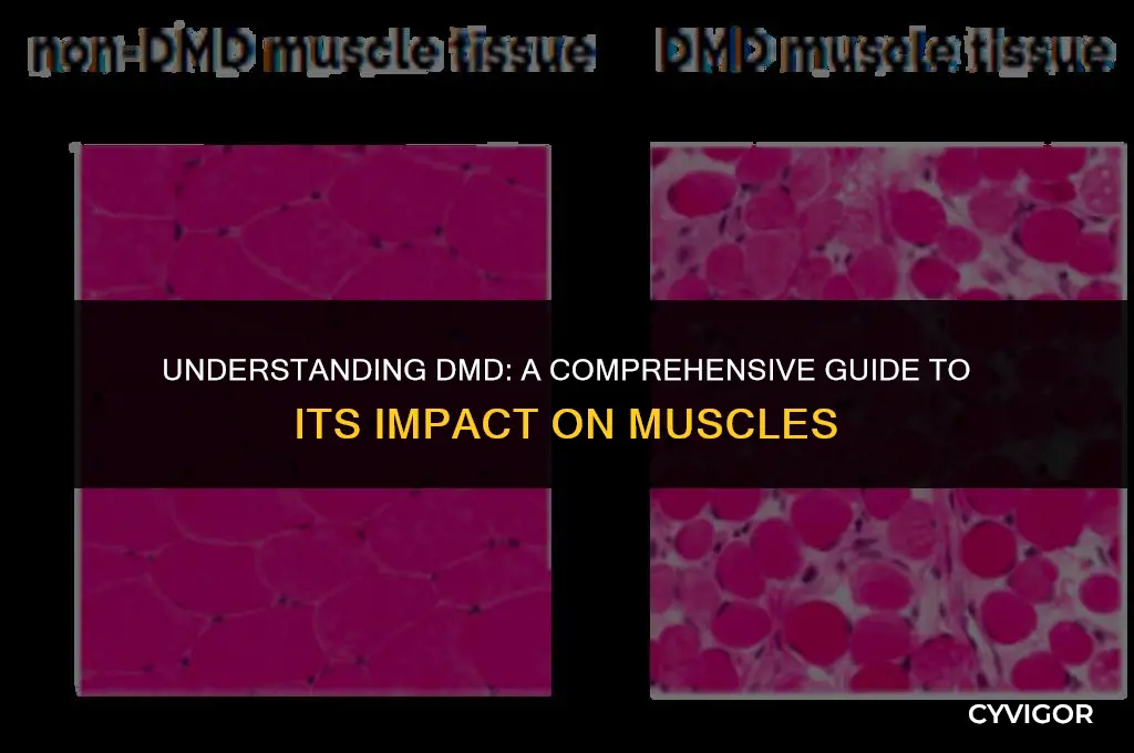 Understanding Dmd: A Comprehensive Guide To Its Impact On Muscles | CyVigor