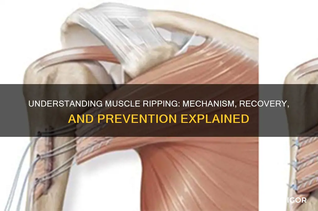 Understanding Muscle Ripping: Mechanism, Recovery, And Prevention ...