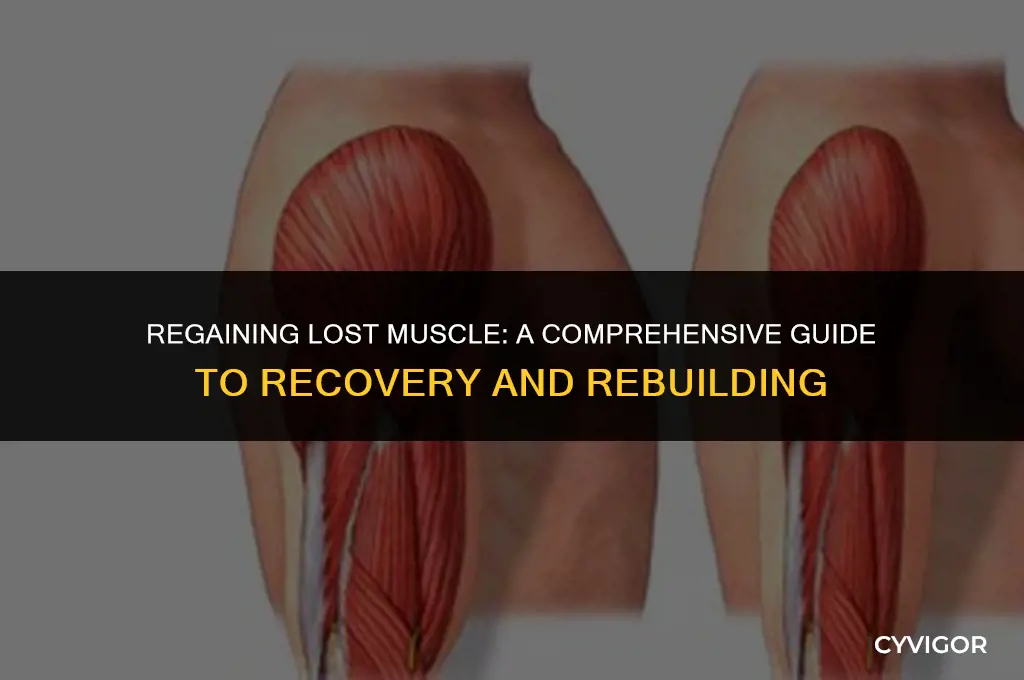 Regaining Lost Muscle: A Comprehensive Guide To Recovery And Rebuilding ...