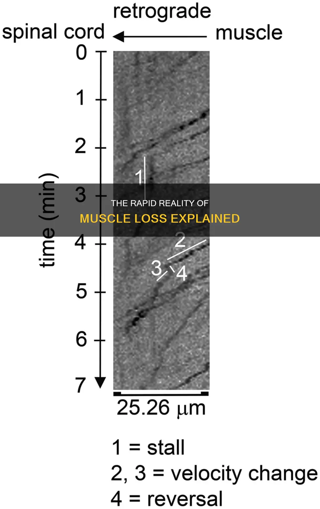 The Rapid Reality Of Muscle Loss Explained | CyVigor