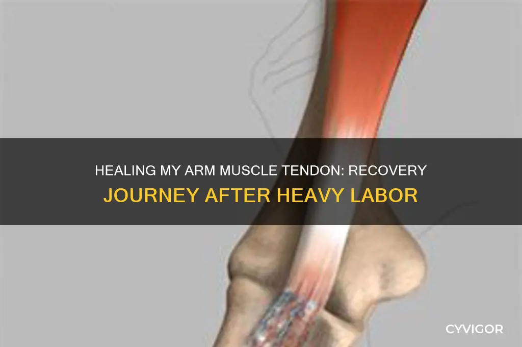 Healing My Arm Muscle Tendon: Recovery Journey After Heavy Labor | CyVigor