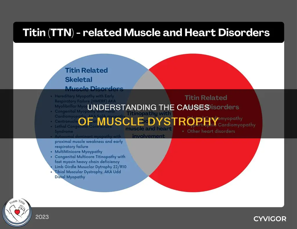 Understanding The Causes Of Muscle Dystrophy | CyVigor