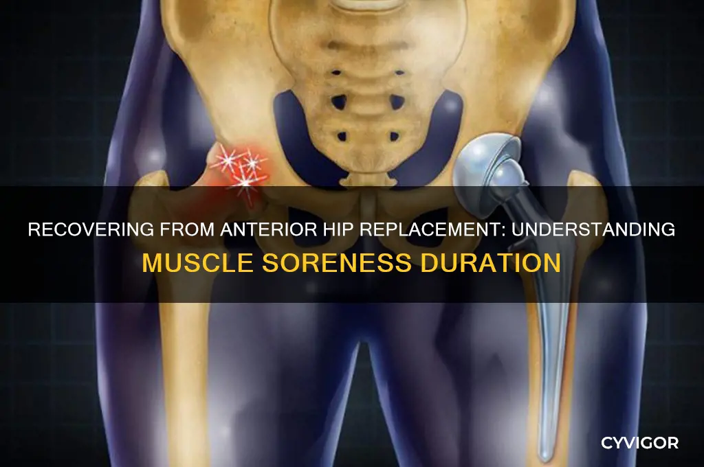 Recovering From Anterior Hip Replacement: Understanding Muscle Soreness ...