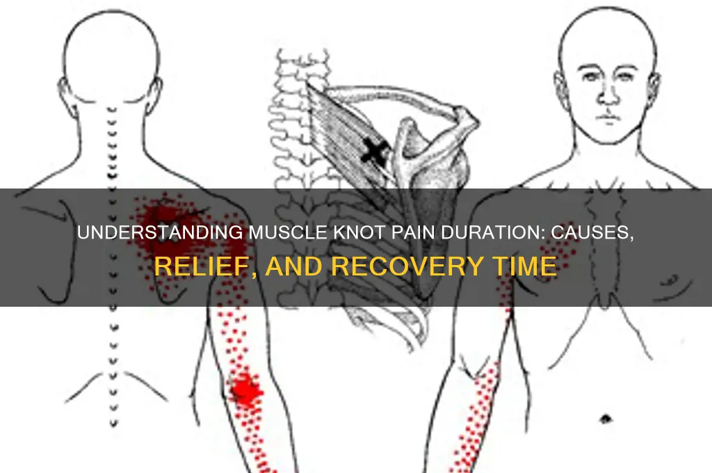 Understanding Muscle Knot Pain Duration: Causes, Relief, And Recovery ...