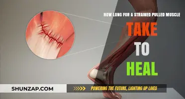 Healing Time For Pulled Forearm Muscles: What To Expect | CyVigor