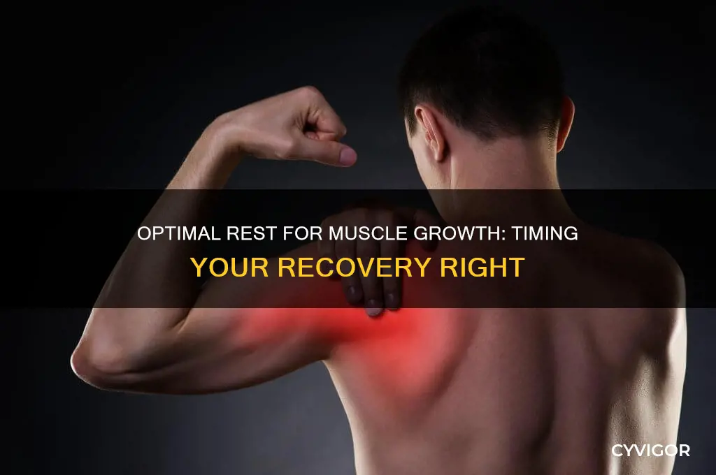 Optimal Rest For Muscle Growth: Timing Your Recovery Right | CyVigor