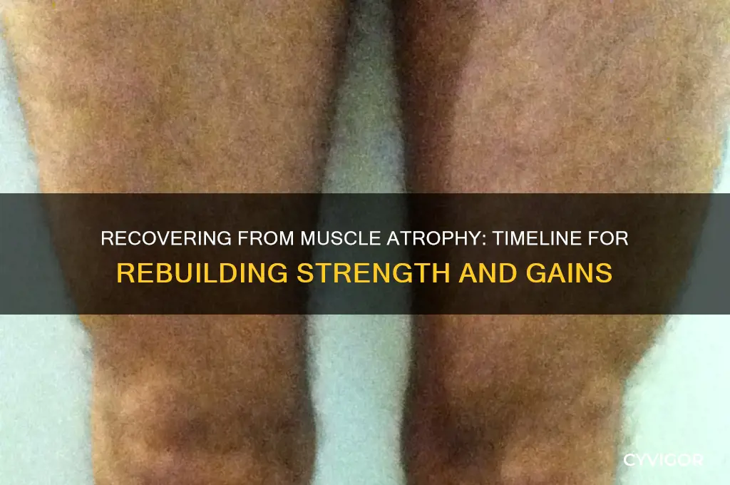Recovering From Muscle Atrophy: Timeline For Rebuilding Strength And ...