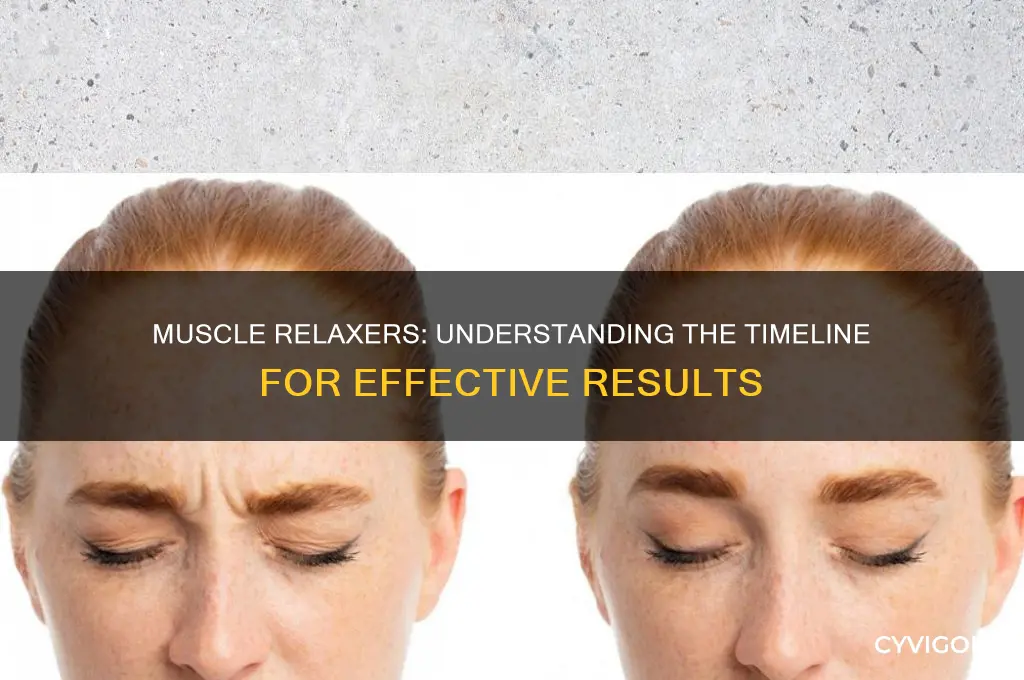 Muscle Relaxers: Understanding The Timeline For Effective Results | CyVigor