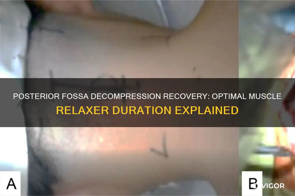 Posterior Fossa Decompression Recovery: Optimal Muscle Relaxer Duration ...