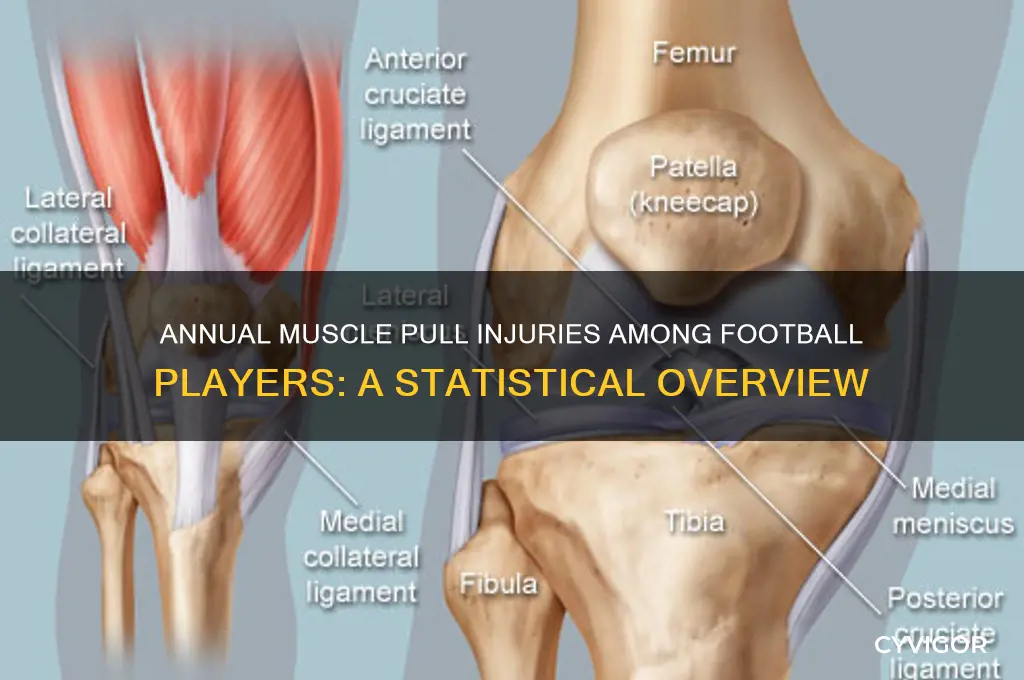 Annual Muscle Pull Injuries Among Football Players: A Statistical ...