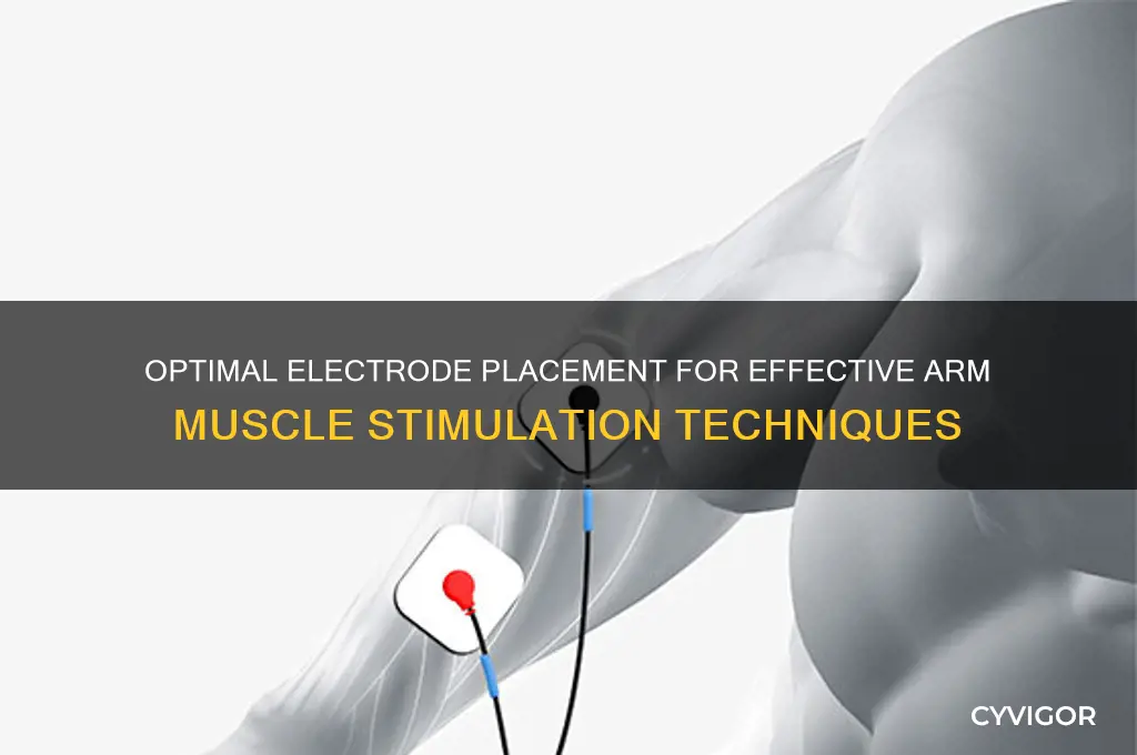 Optimal Electrode Placement For Effective Arm Muscle Stimulation ...