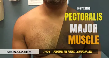 Tendons' Intricate Attachment To Muscles Explained | CyVigor