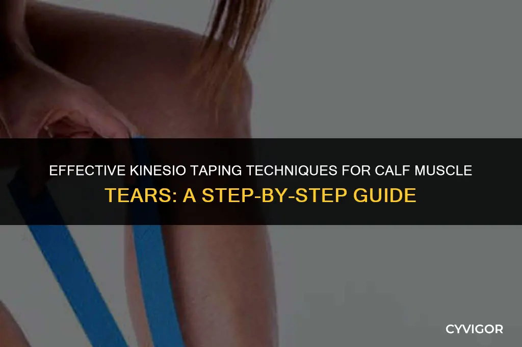 Effective Kinesio Taping Techniques For Calf Muscle Tears: A Step-By ...