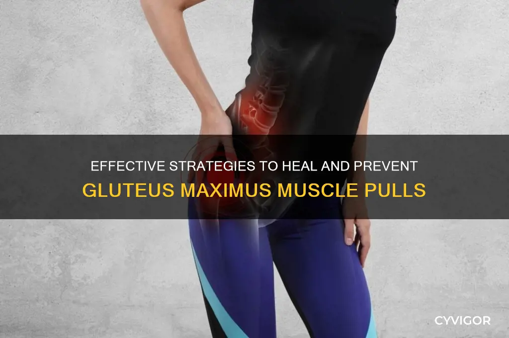Effective Strategies To Heal And Prevent Gluteus Maximus Muscle Pulls ...