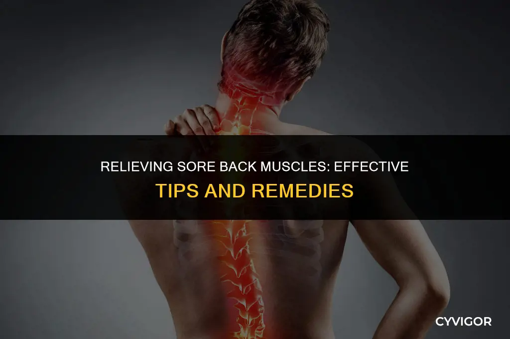 Relieving Sore Back Muscles: Effective Tips And Remedies | CyVigor