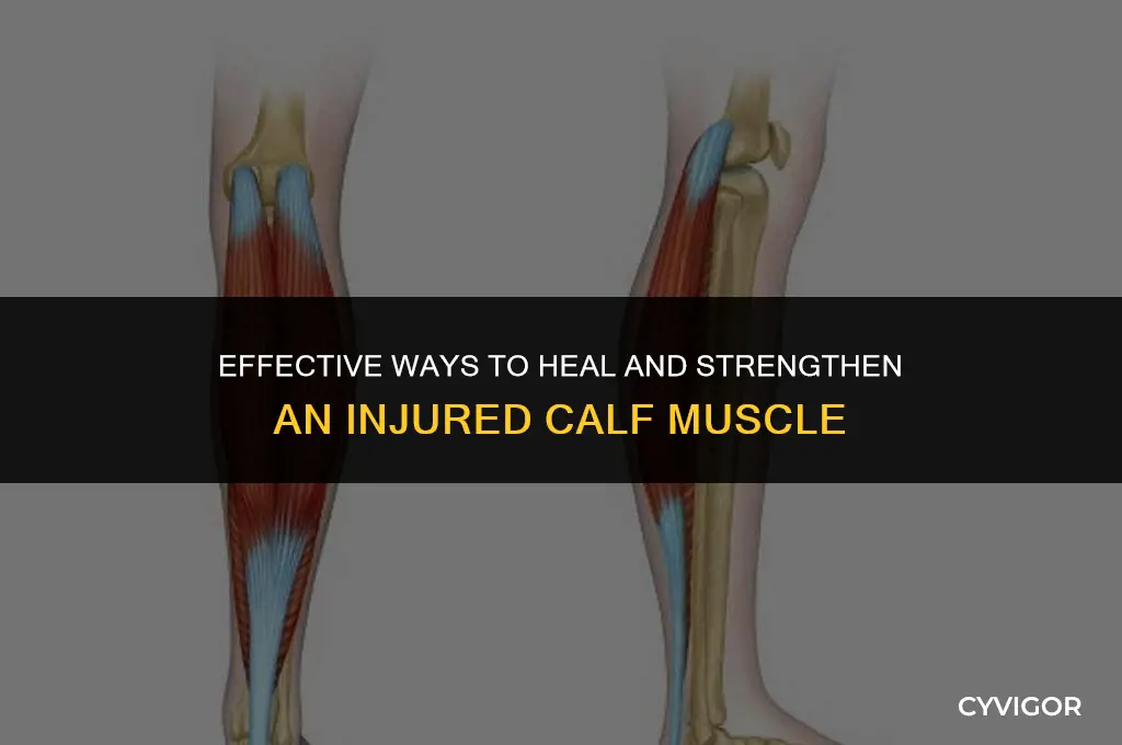 Effective Ways To Heal And Strengthen An Injured Calf Muscle | CyVigor