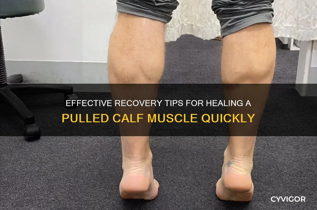 Effective Recovery Tips For Healing A Pulled Calf Muscle Quickly | CyVigor