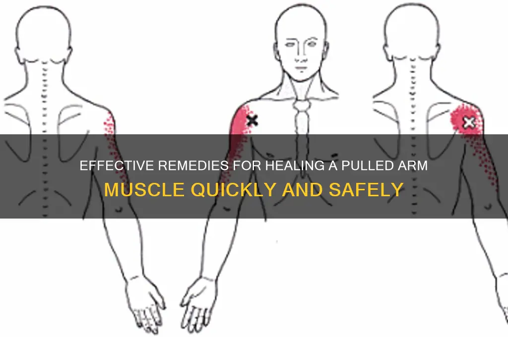 Effective Remedies For Healing A Pulled Arm Muscle Quickly And Safely ...