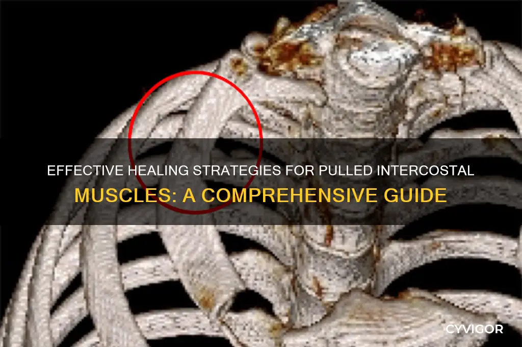 Effective Healing Strategies For Pulled Intercostal Muscles: A ...