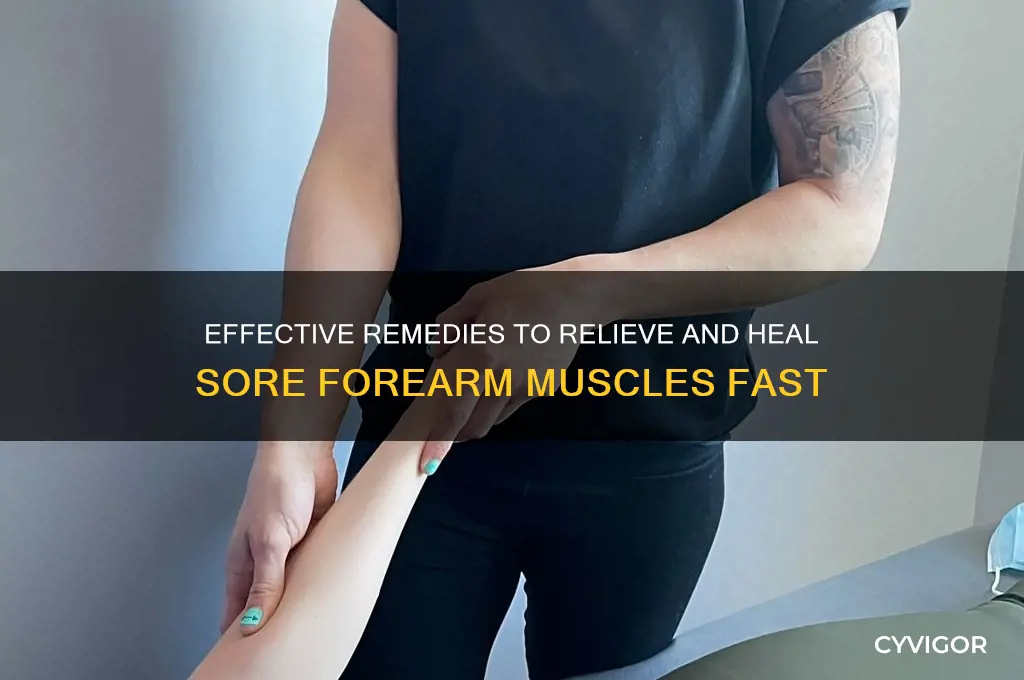 Effective Remedies To Relieve And Heal Sore Forearm Muscles Fast | CyVigor