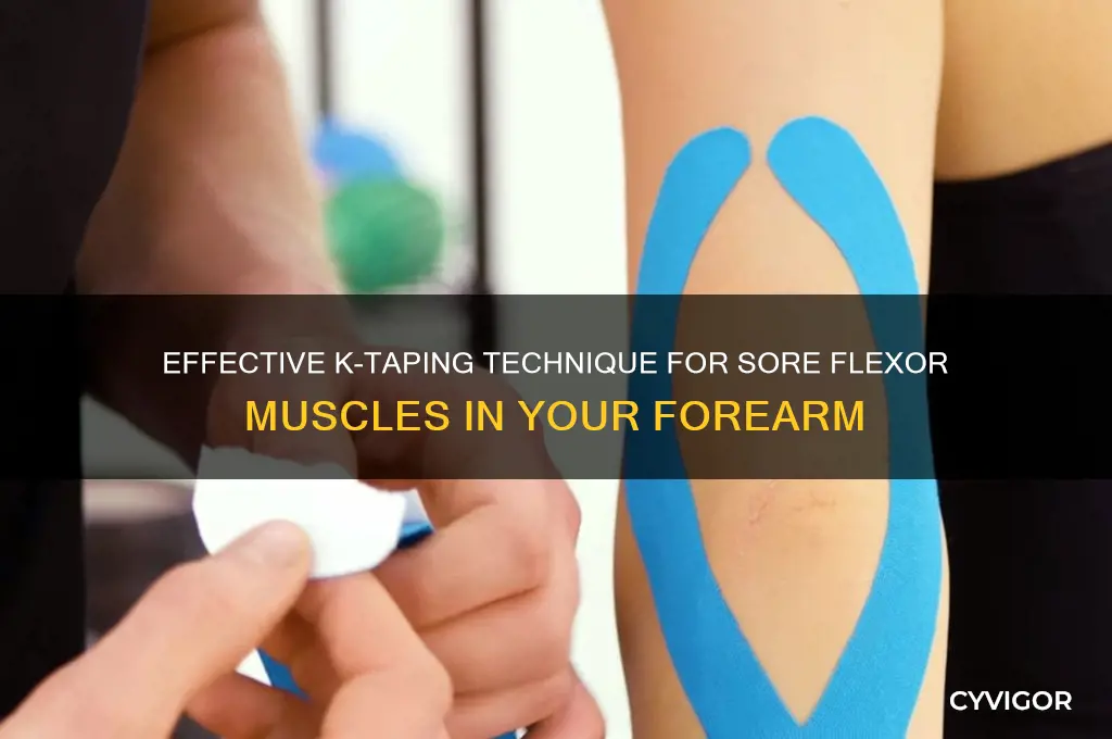 Effective K-Taping Technique For Sore Flexor Muscles In Your Forearm ...