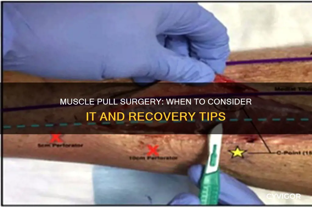 Muscle Pull Surgery: When To Consider It And Recovery Tips | CyVigor
