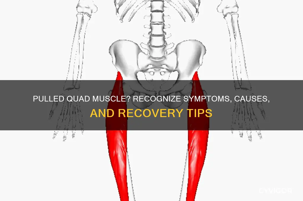 Pulled Quad Muscle? Recognize Symptoms, Causes, And Recovery Tips | CyVigor