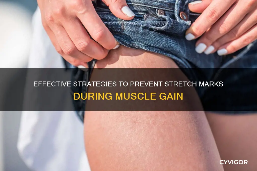 Effective Strategies To Prevent Stretch Marks During Muscle Gain | CyVigor