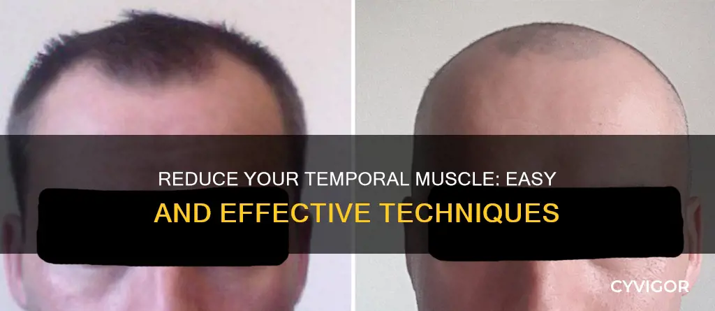 Reduce Your Temporal Muscle: Easy And Effective Techniques | CyVigor