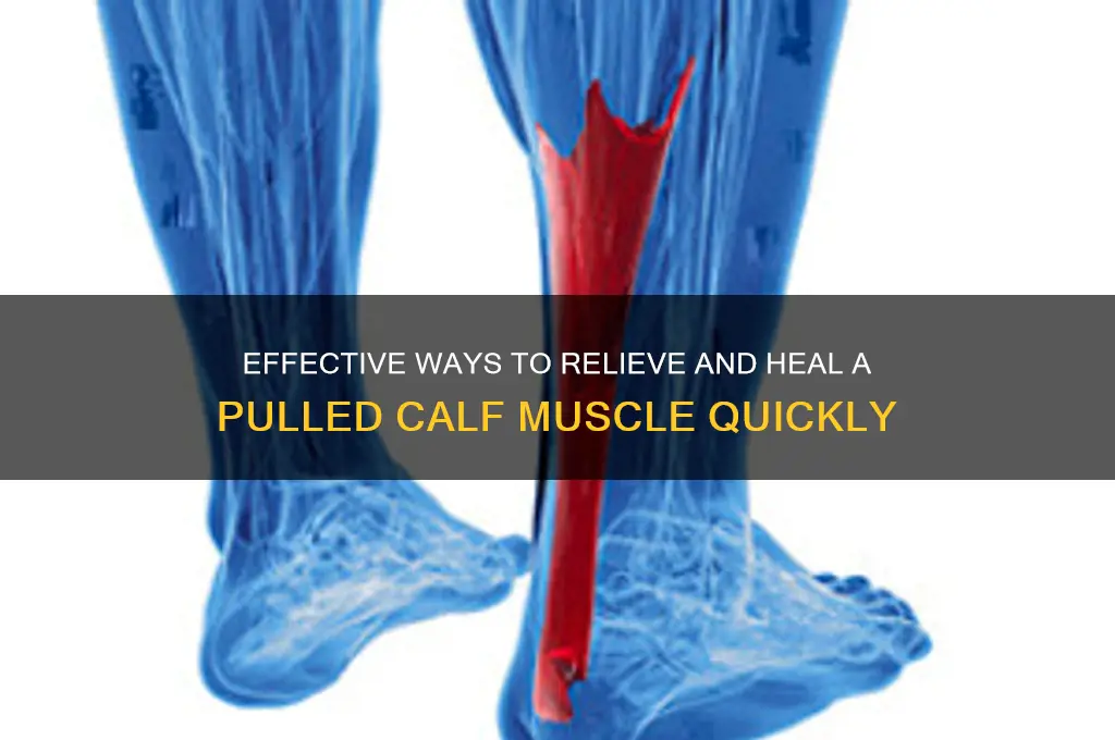 Effective Ways To Relieve And Heal A Pulled Calf Muscle Quickly | CyVigor