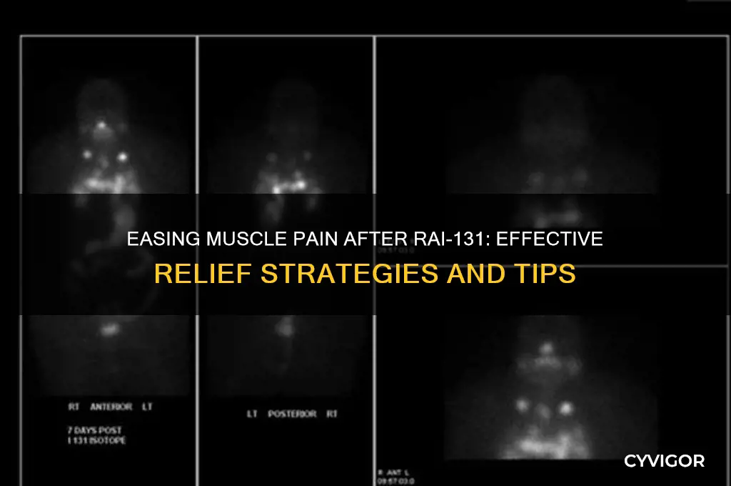 Easing Muscle Pain After Rai-131: Effective Relief Strategies And Tips ...
