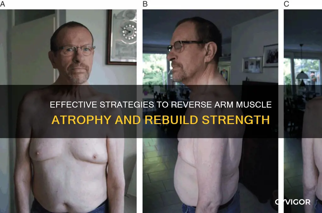 Effective Strategies To Reverse Arm Muscle Atrophy And Rebuild Strength ...