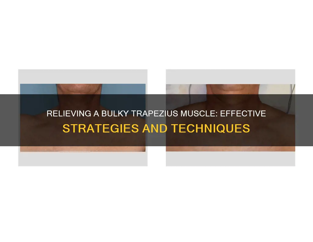 Relieving A Bulky Trapezius Muscle: Effective Strategies And Techniques ...