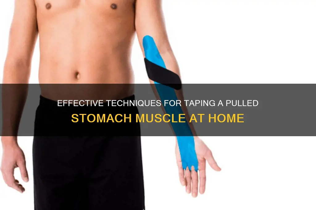 Effective Techniques For Taping A Pulled Stomach Muscle At Home | CyVigor