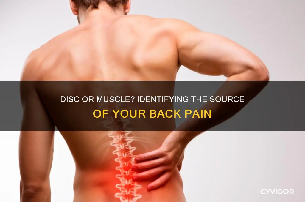 Disc Or Muscle? Identifying The Source Of Your Back Pain | CyVigor
