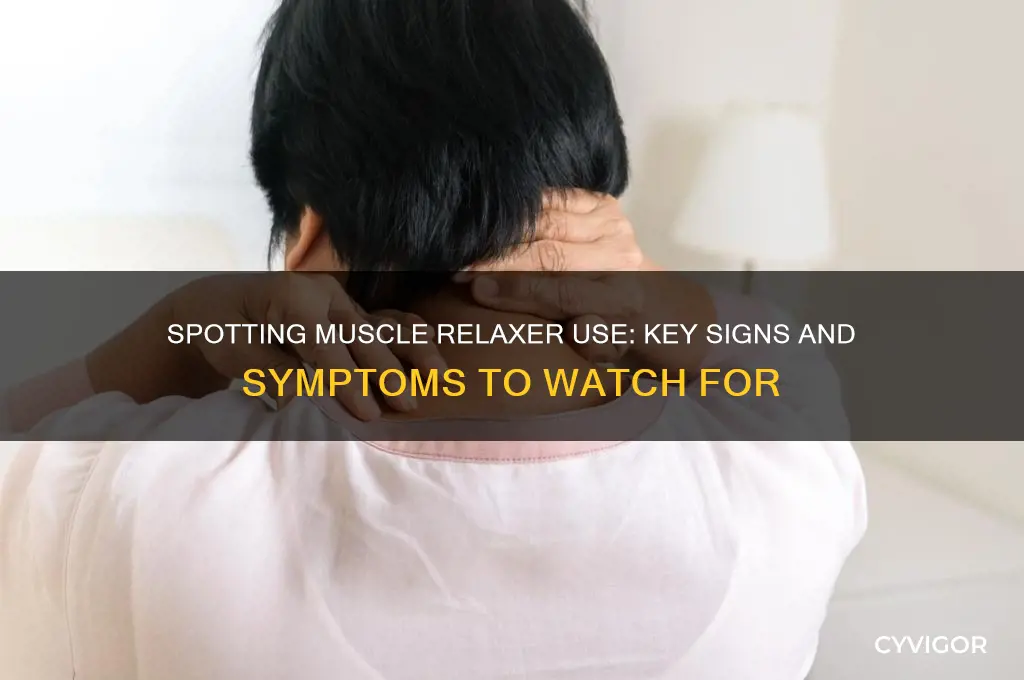 Spotting Muscle Relaxer Use: Key Signs And Symptoms To Watch For | CyVigor
