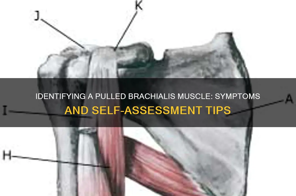 Identifying A Pulled Brachialis Muscle: Symptoms And Self-Assessment ...