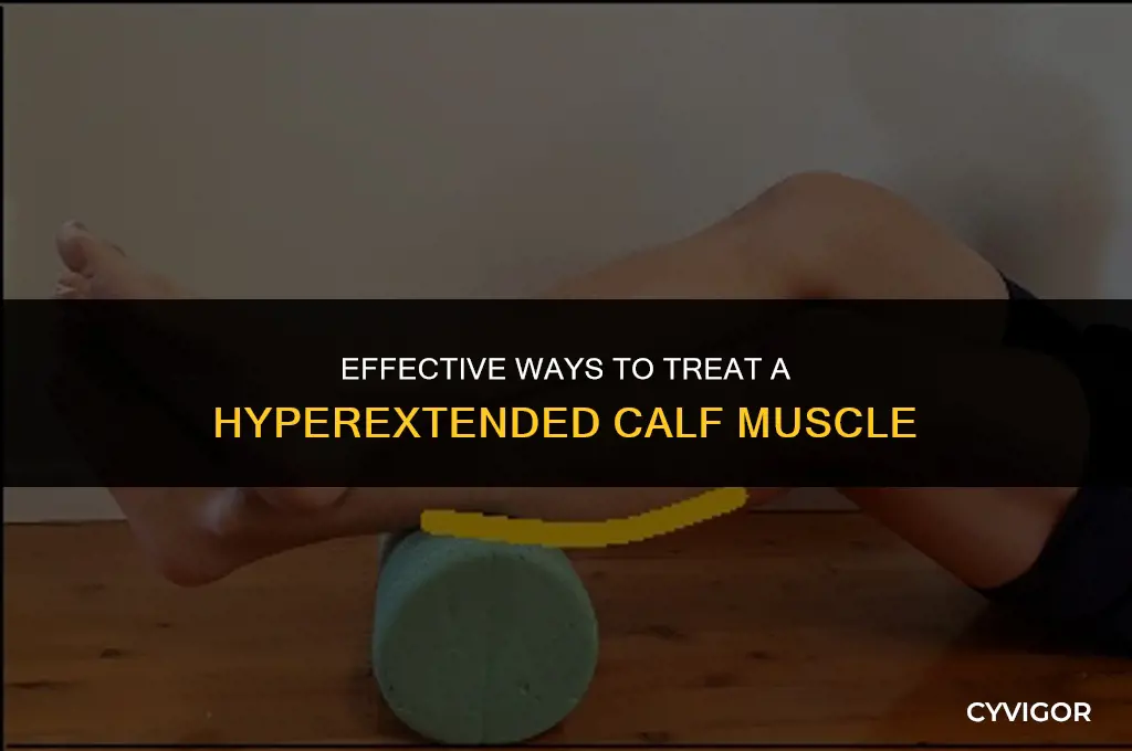 Effective Ways To Treat A Hyperextended Calf Muscle | CyVigor