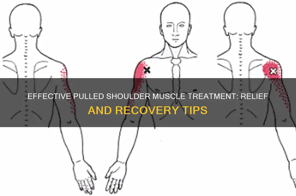 Effective Pulled Shoulder Muscle Treatment: Relief And Recovery Tips ...