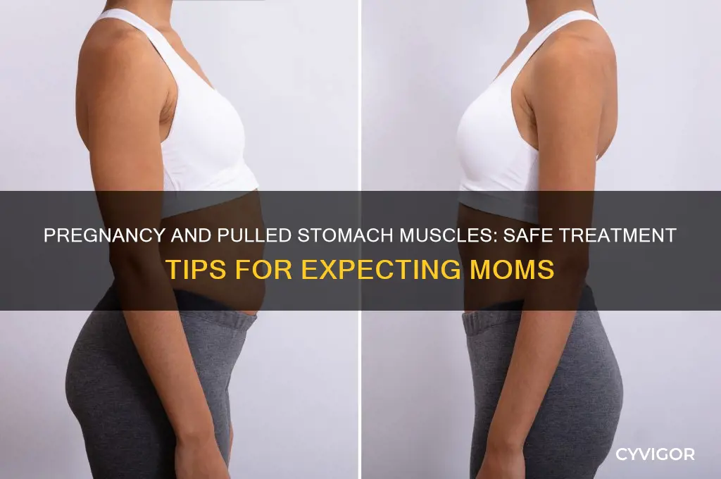 Pregnancy And Pulled Stomach Muscles: Safe Treatment Tips For Expecting ...