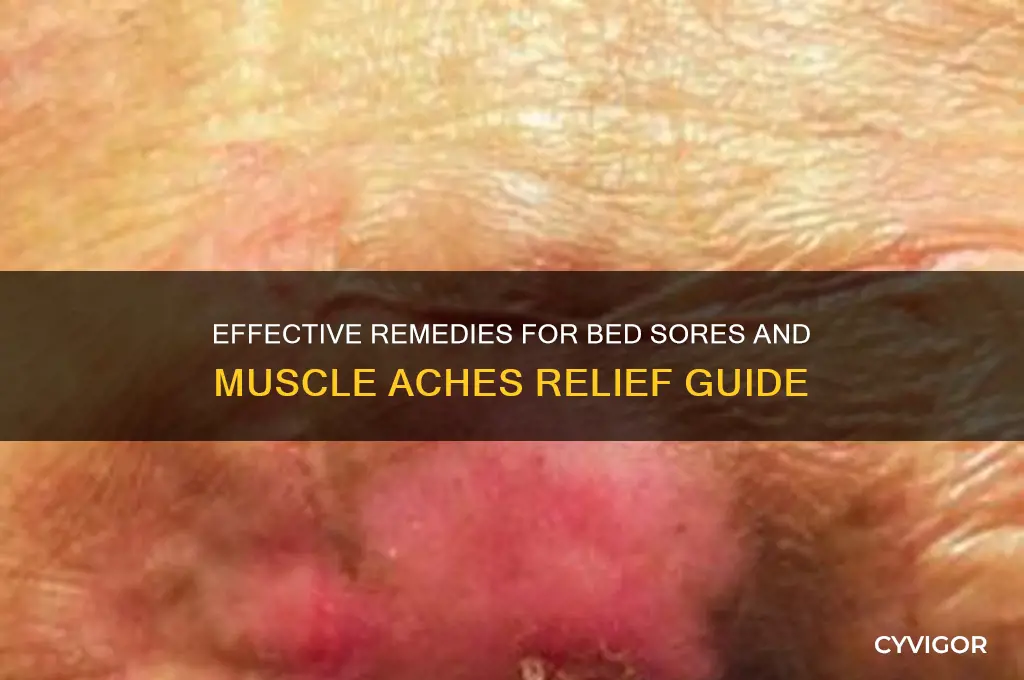 Effective Remedies For Bed Sores And Muscle Aches Relief Guide | CyVigor