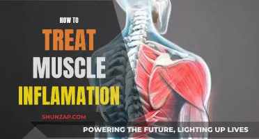 Treating Muscle Contractures: Effective Strategies For Relief And ...